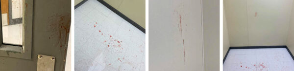 ‘I’m Not Safe Here’: What Happens to Kids When Schools Use Restraint ...