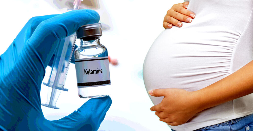 Ketamine Poses Serious Risks for Pregnant Women, But Providers Often ...