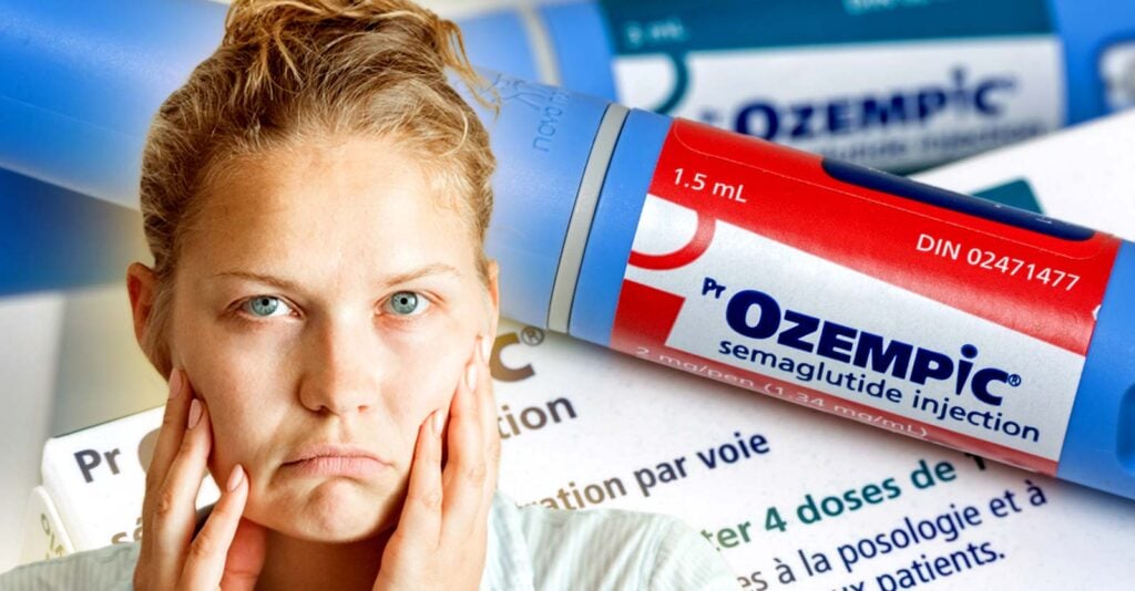 ‘Ozempic Face’: What Is It? And What Does It Mean? • Children's Health ...